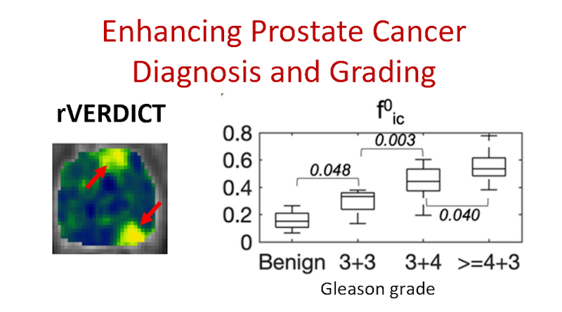 Dr Marco Palombo - People - Cardiff University