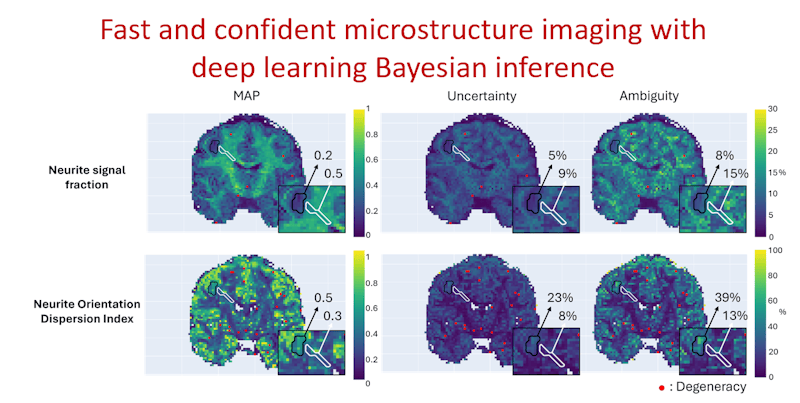 Dr Marco Palombo - People - Cardiff University